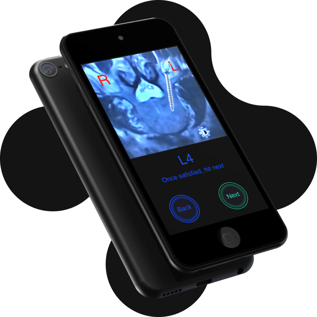 Bolt Nav - Spinal Surgery, Simplified