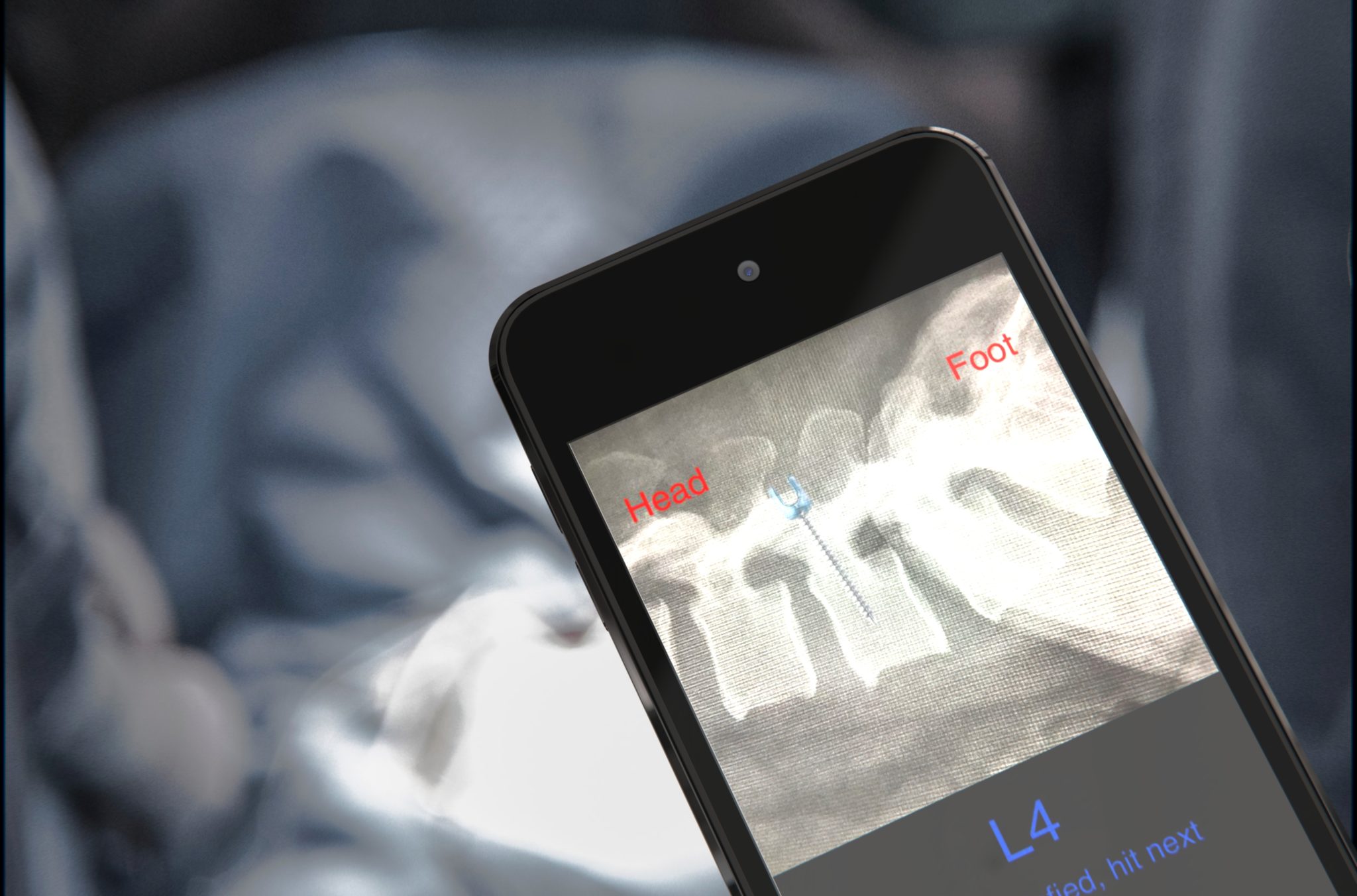 Bolt Nav - Spinal Surgery, Simplified