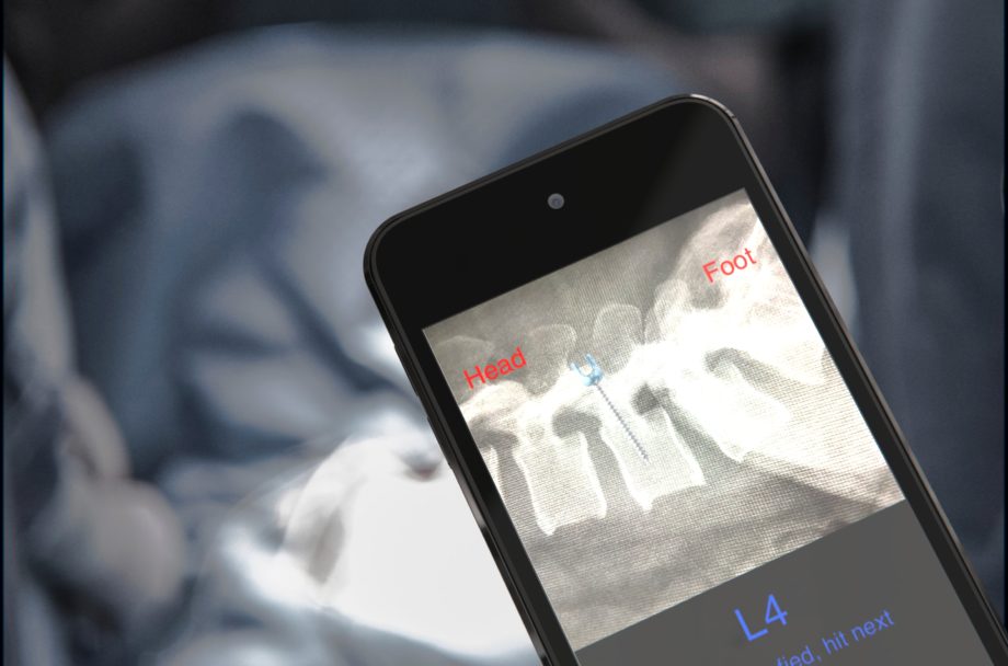 Bolt Nav - Spinal Surgery, Simplified