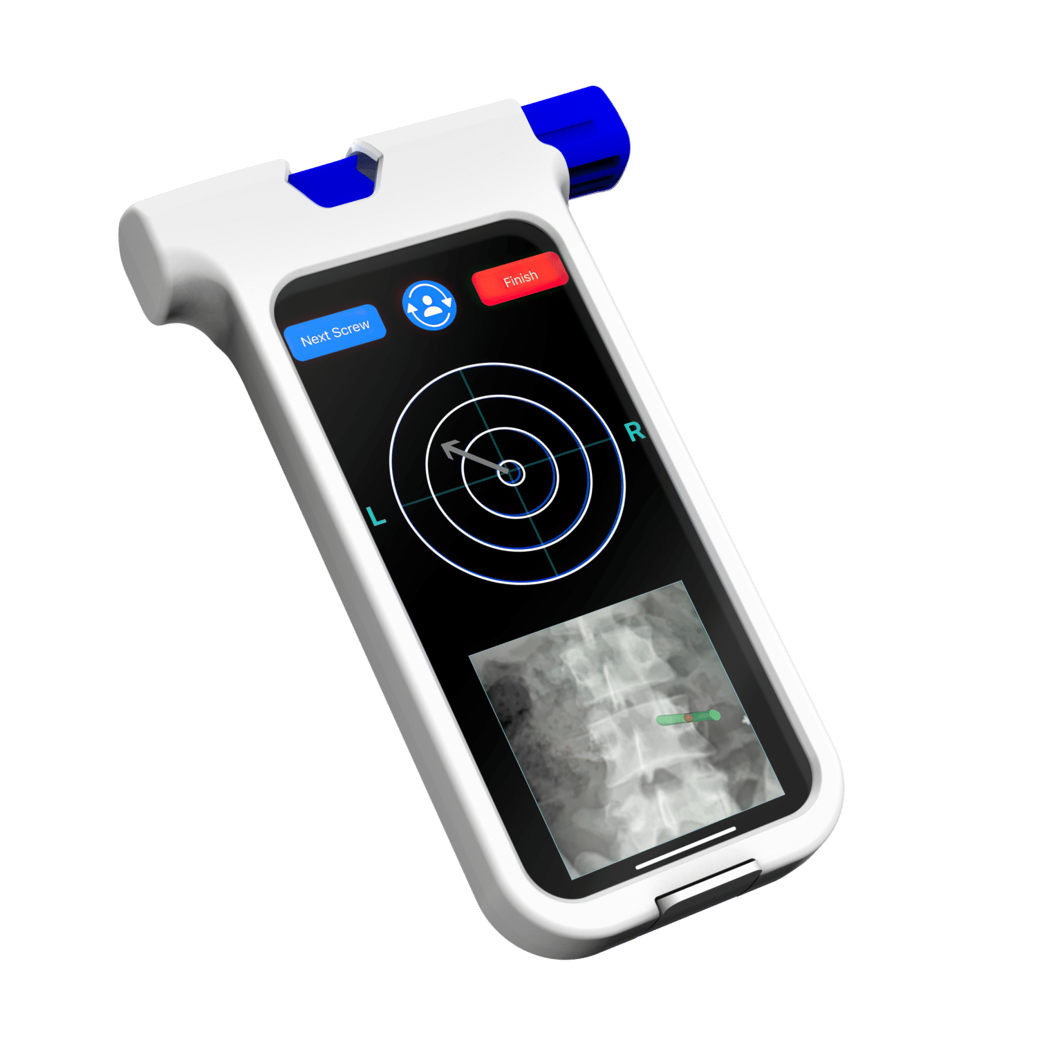 Bolt Nav - Spinal Surgery, Simplified