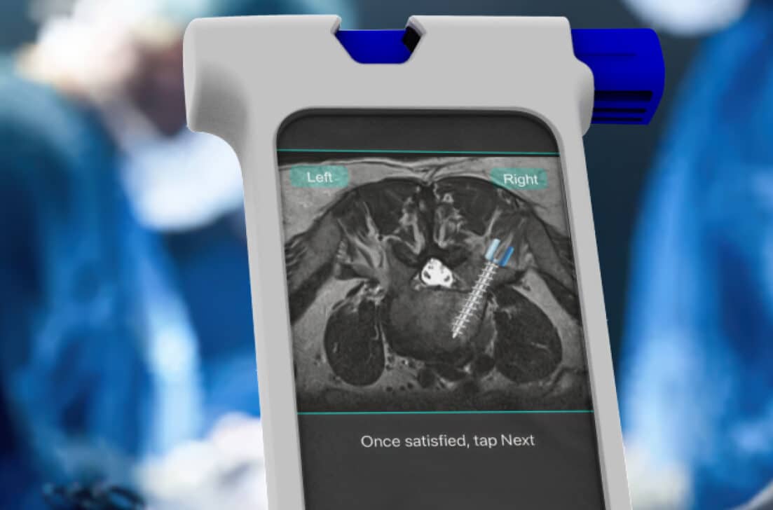 Bolt Nav - Spinal Surgery, Simplified